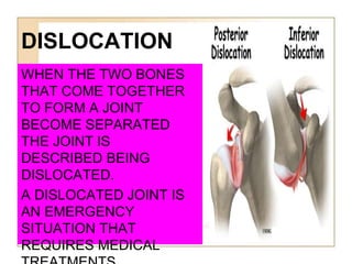Common injuries ppt w2 | PPTX