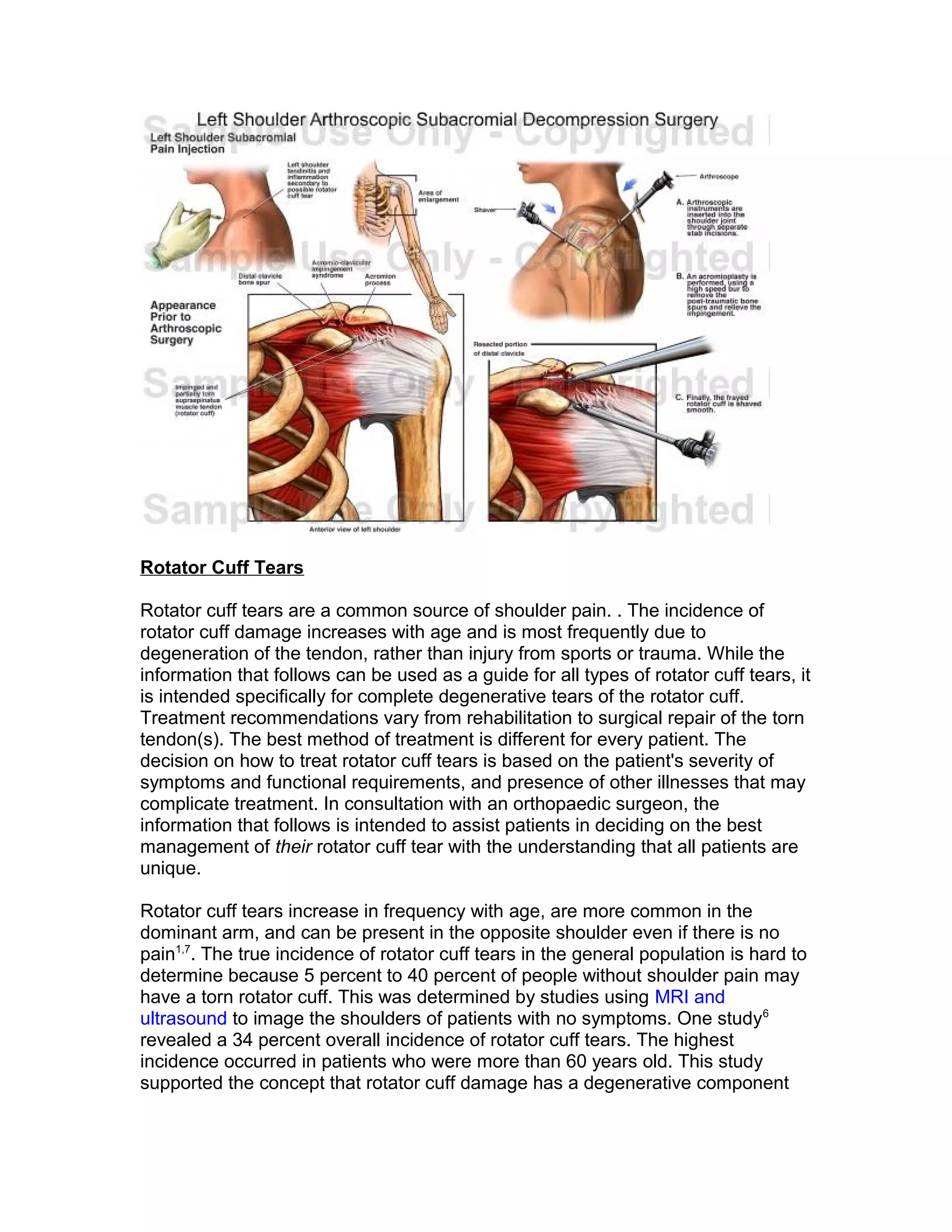 Common injuries to the upper extremity | DOC
