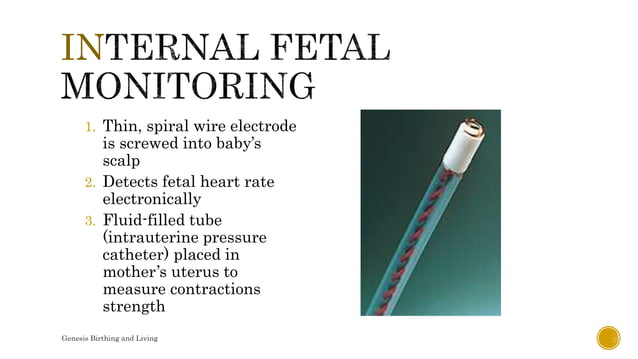 Top 10 Most Common Labor Interventions | PPTX