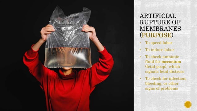 Top 10 Most Common Labor Interventions | PPTX