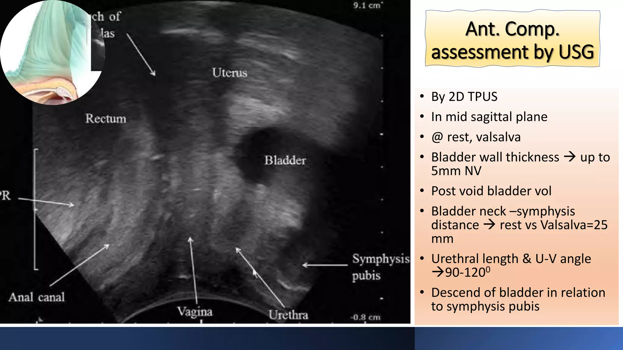 common investigations for pelvic floor.pptx