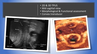common investigations for pelvic floor.pptx