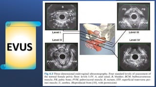 common investigations for pelvic floor.pptx
