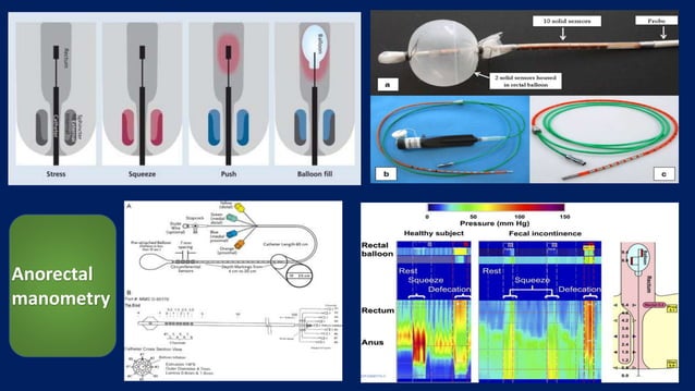 common investigations for pelvic floor.pptx