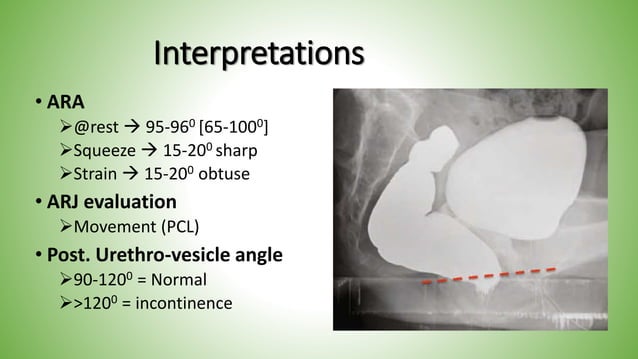 common investigations for pelvic floor.pptx | Free Download