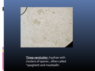 Common investigations in dermatology | PPT | Skin and Dermatology ...