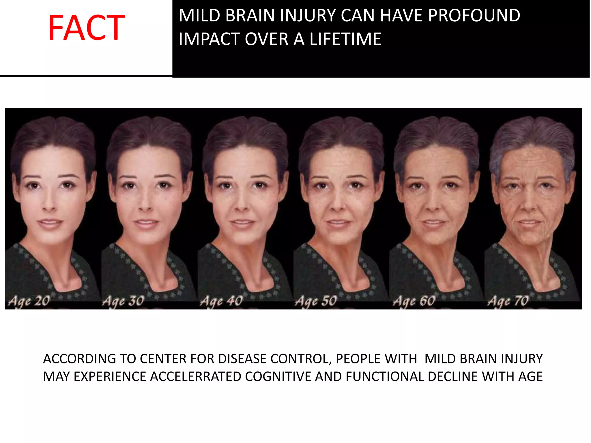 Common issues in handling a traumatic brain injury case | PPTX