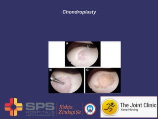 Common Knee & Shoulder Problems - Copy - Copy.ppt
