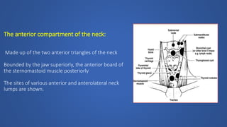 Common neck swellings | PPTX