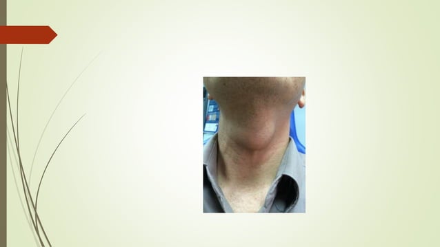 COMMON NECK SWELLINGS BATANDA JOEL (1).pptx