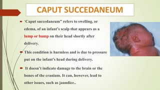 Common neonatal disorder BSC Nursing 3r year | PPT