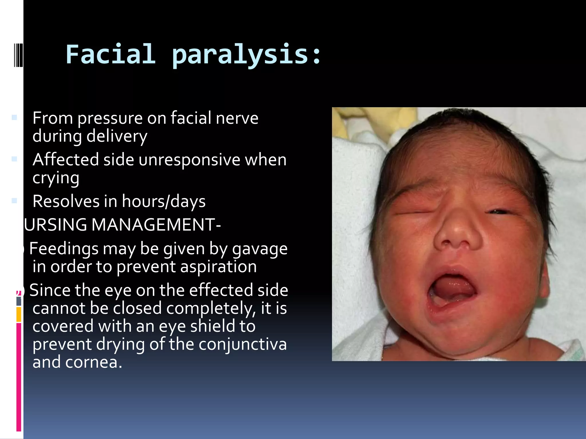 Common neonatal disorders | PPTX