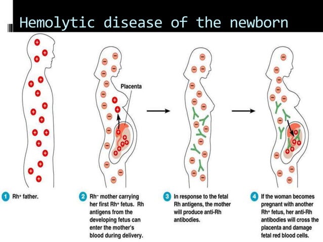 Common neonatal disorders | PPTX