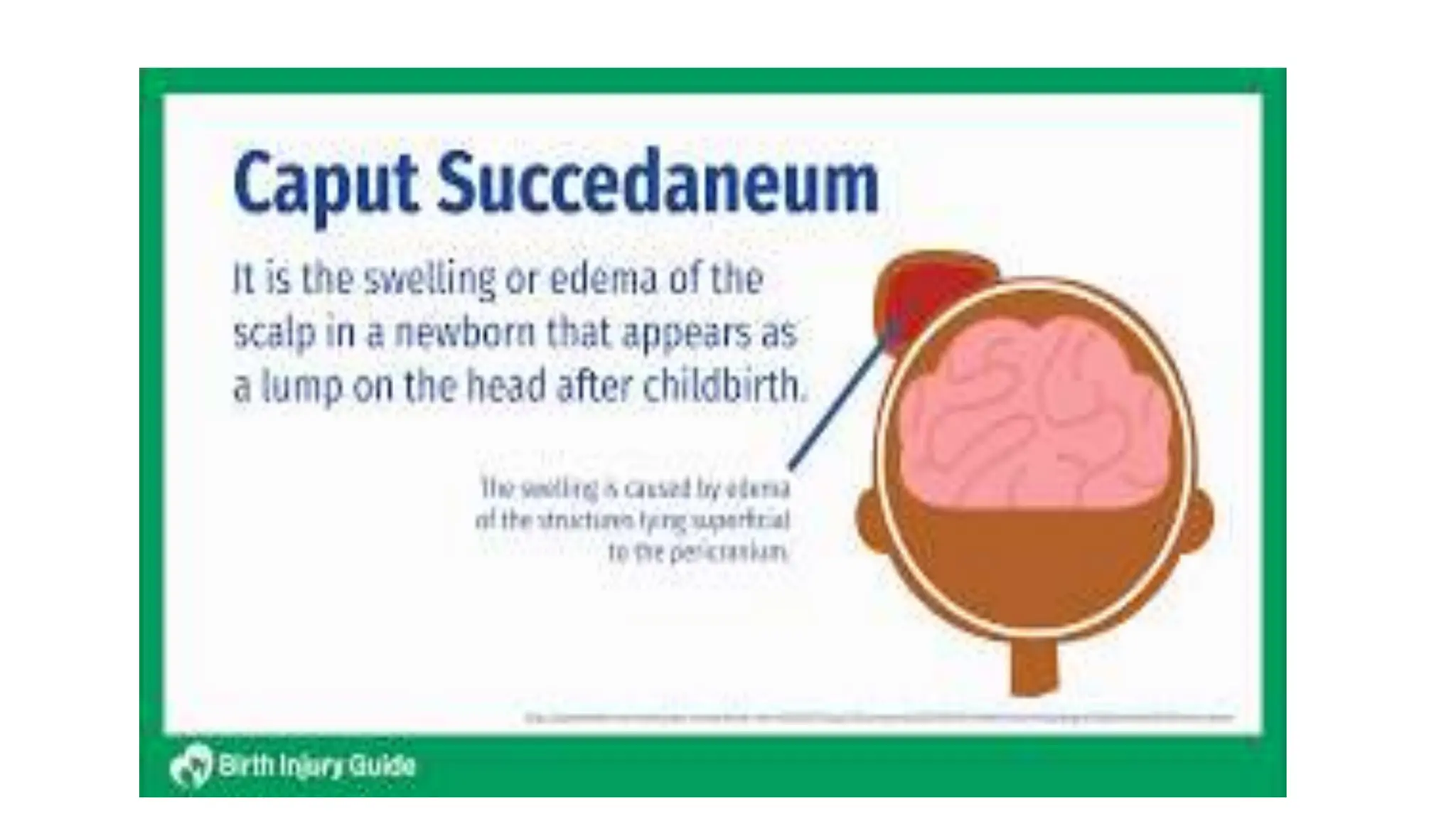 Common neonatal disorders.pptx