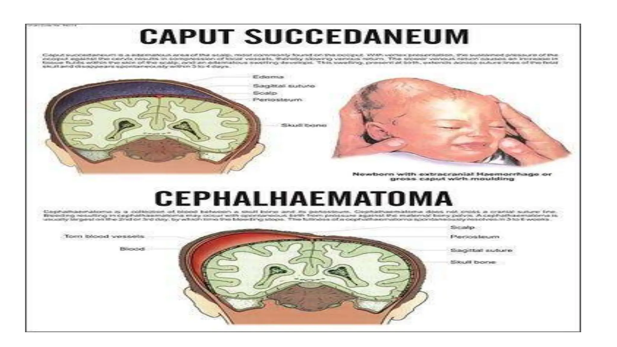 Common neonatal disorders.pptx