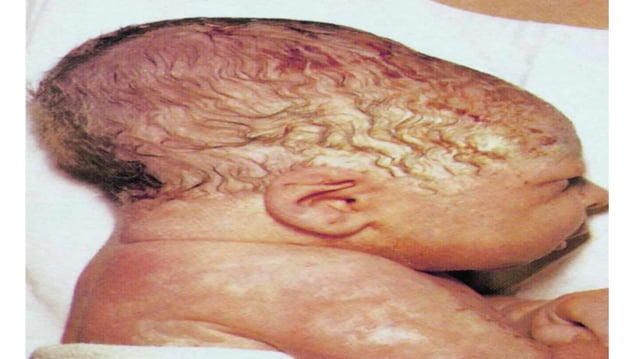 Common neonatal disorders.pptx