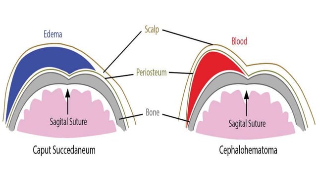 Common neonatal disorders.pptx