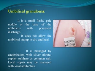 common neonatal problem.pptxewrglugriulg | PPTX