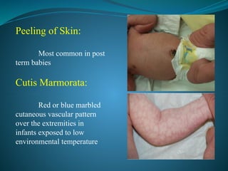 common neonatal problem.pptxewrglugriulg | PPTX