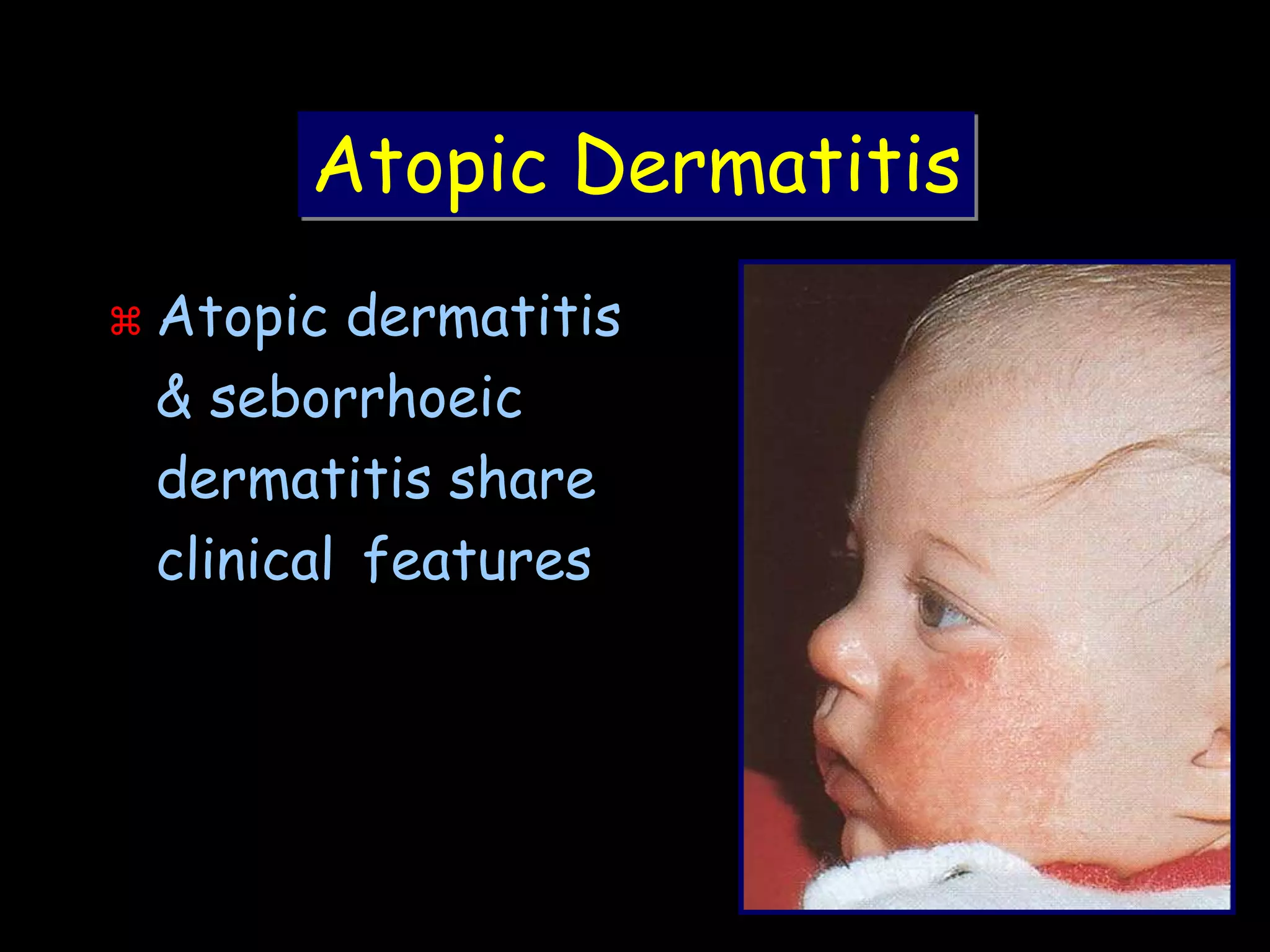 Common neonatal problems | PPT