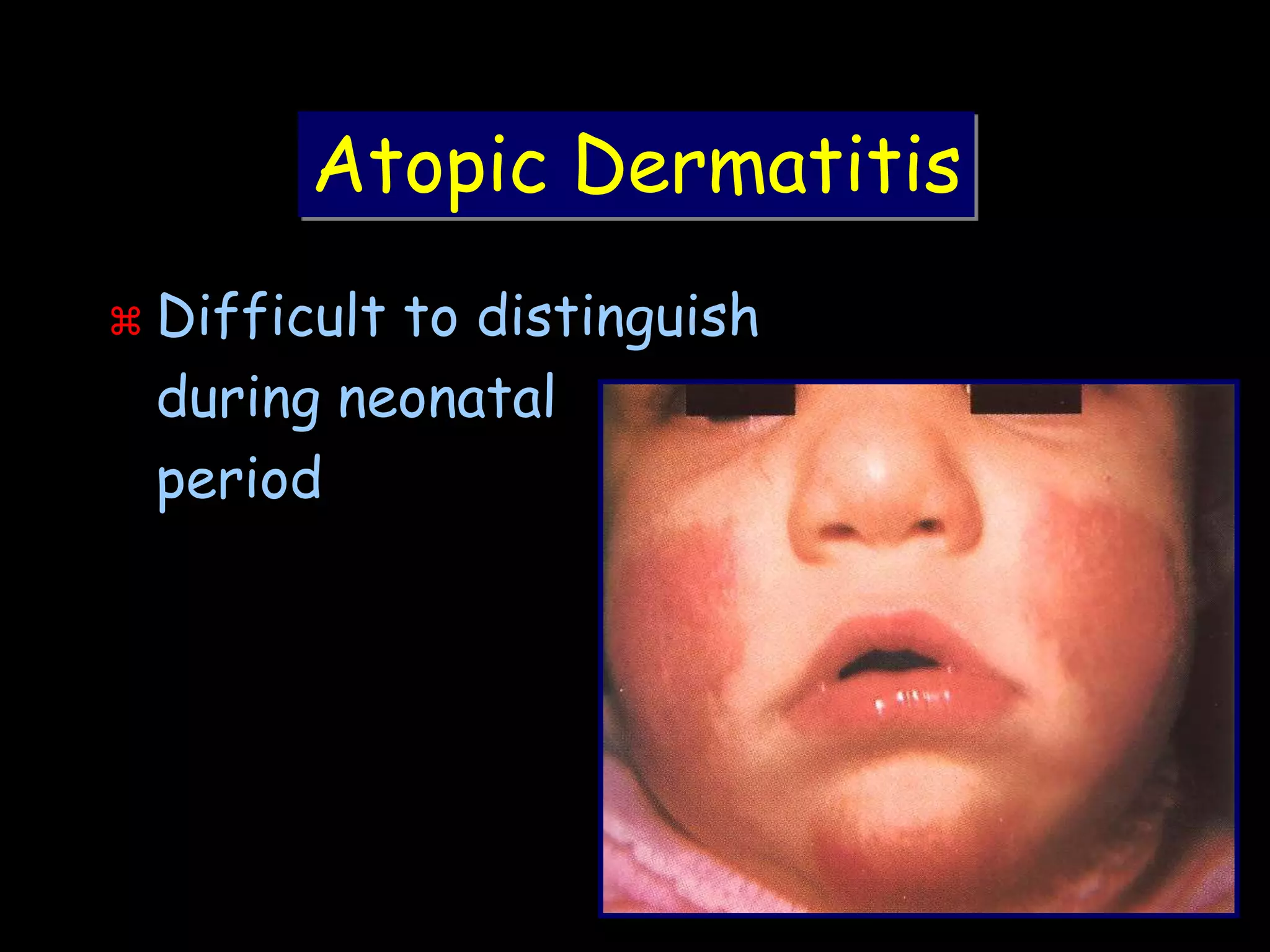 Common neonatal problems | PPT