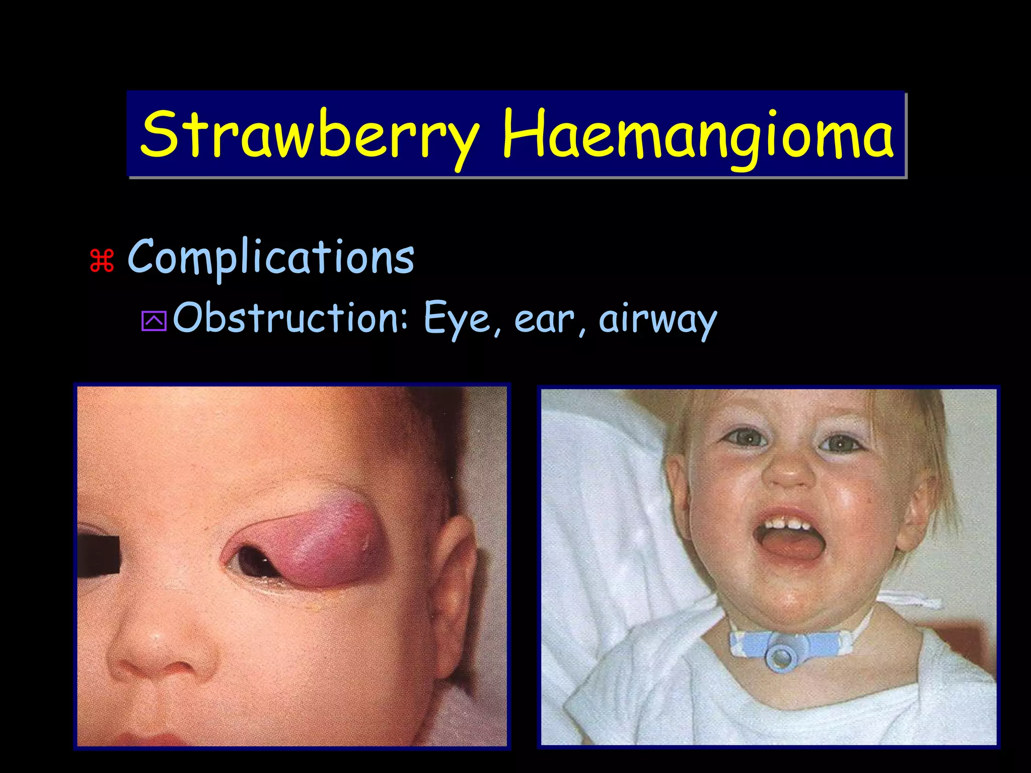 Common neonatal problems | PPT