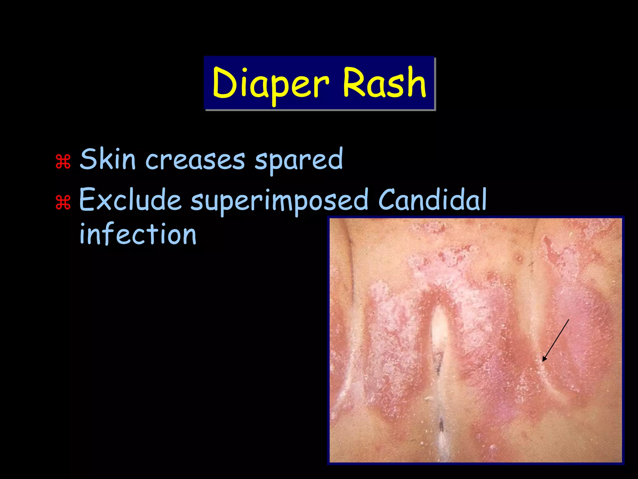 Common neonatal problems | PPT