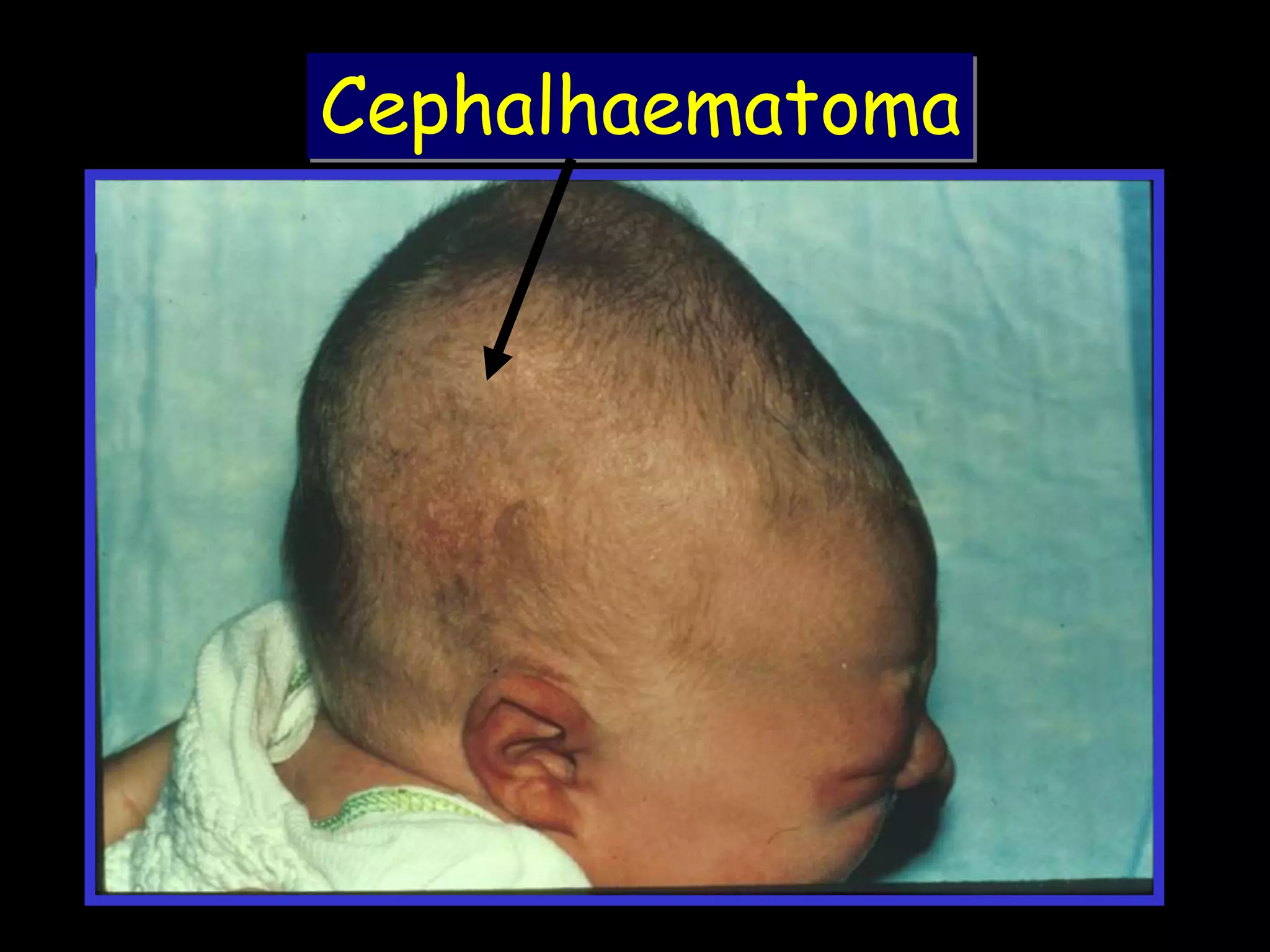 Common neonatal problems | PPT