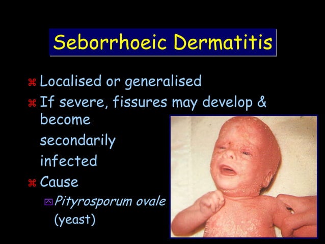 Common neonatal problems | PPT