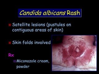 Common neonatal problems | PPT