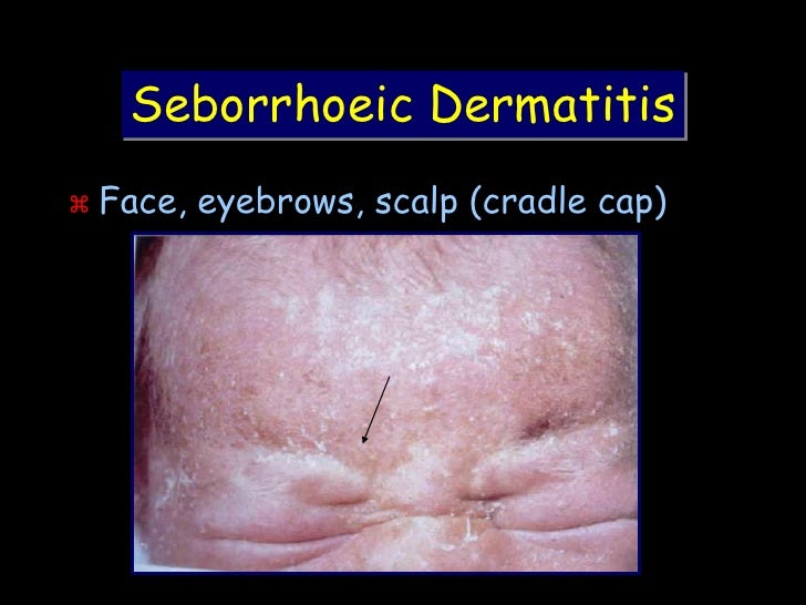 Common neonatal problems