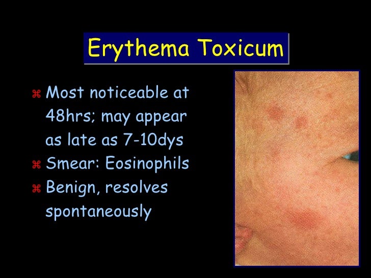 Common neonatal problems