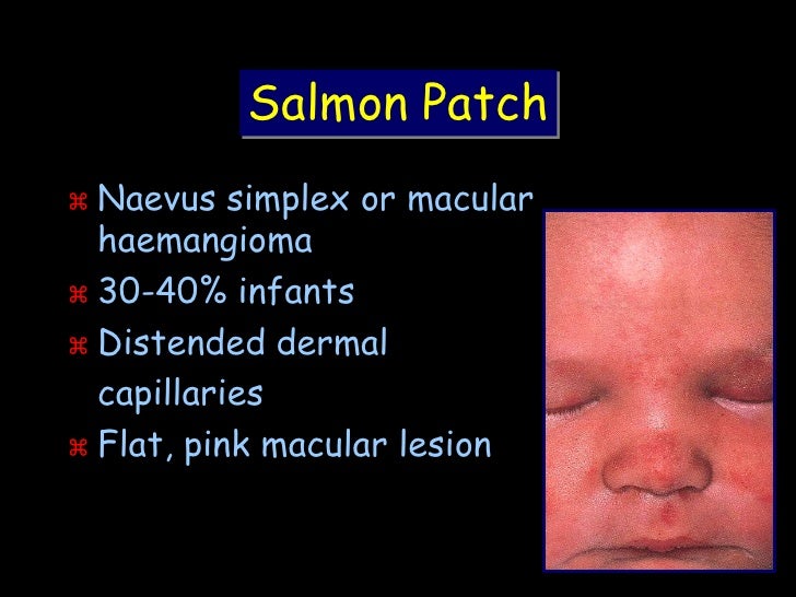 Common neonatal problems