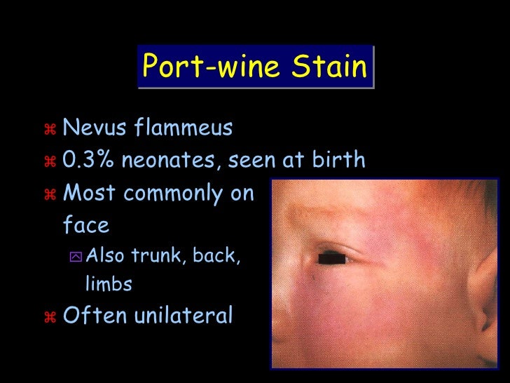 Common neonatal problems