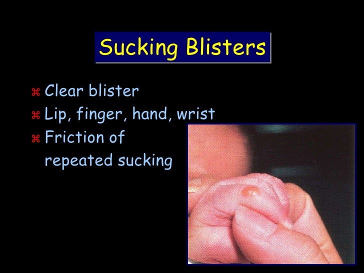 Common neonatal problems