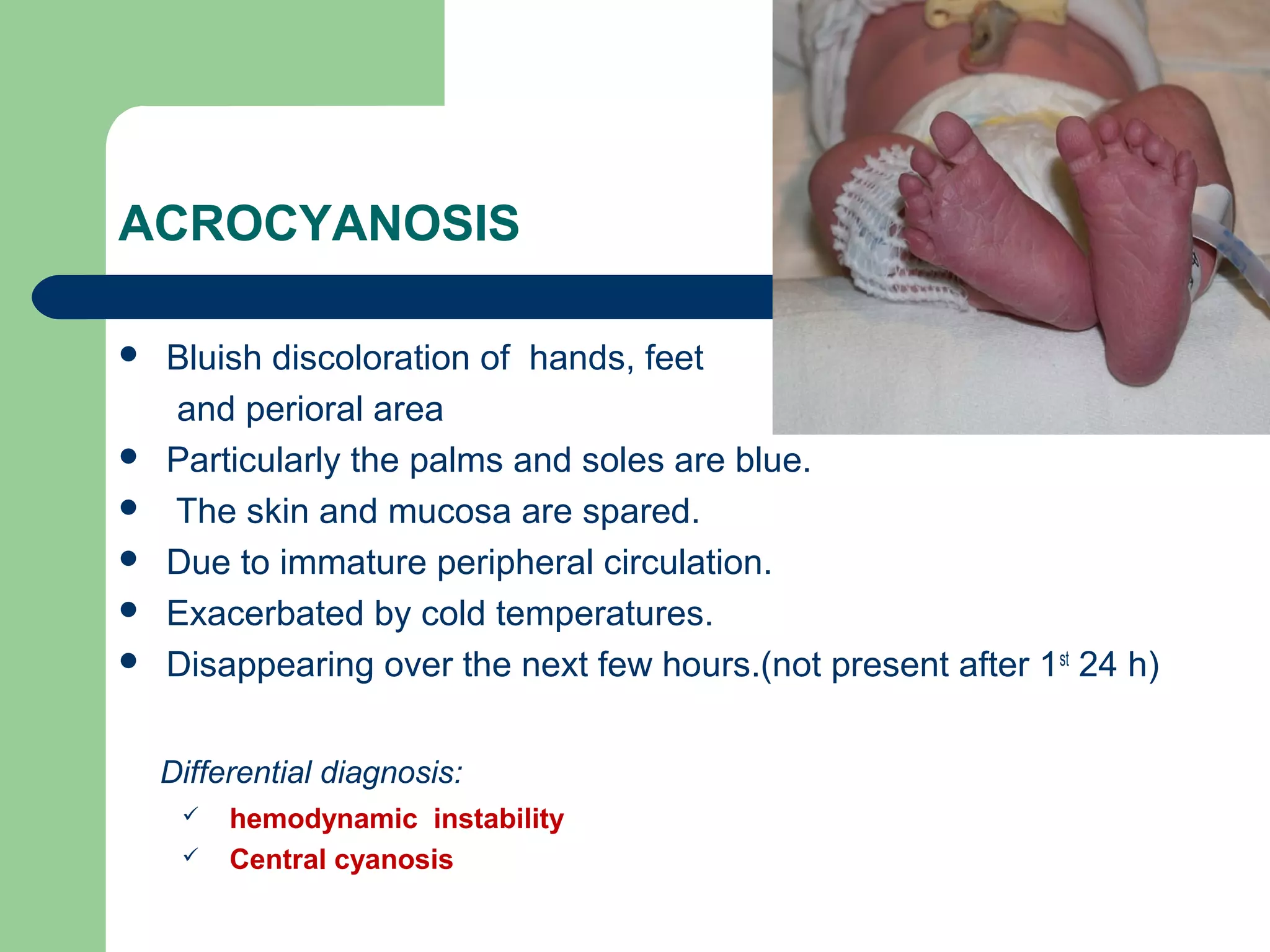 Common neonatal problems | PPT