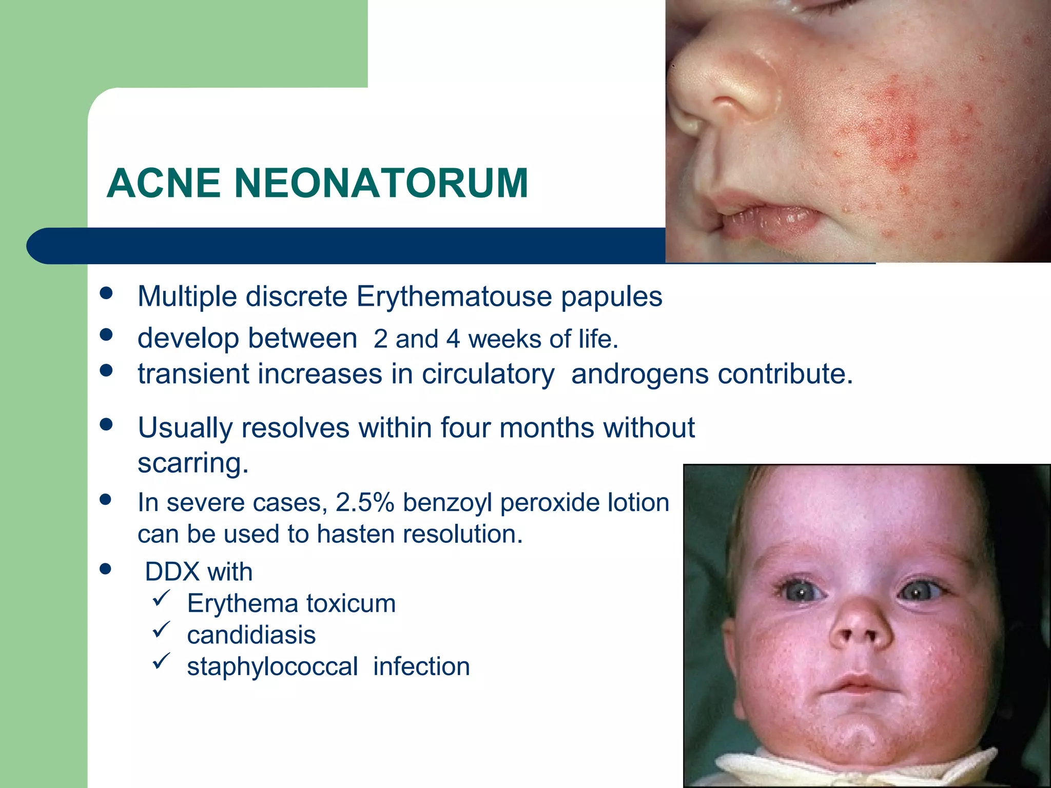 Common neonatal problems | PPT
