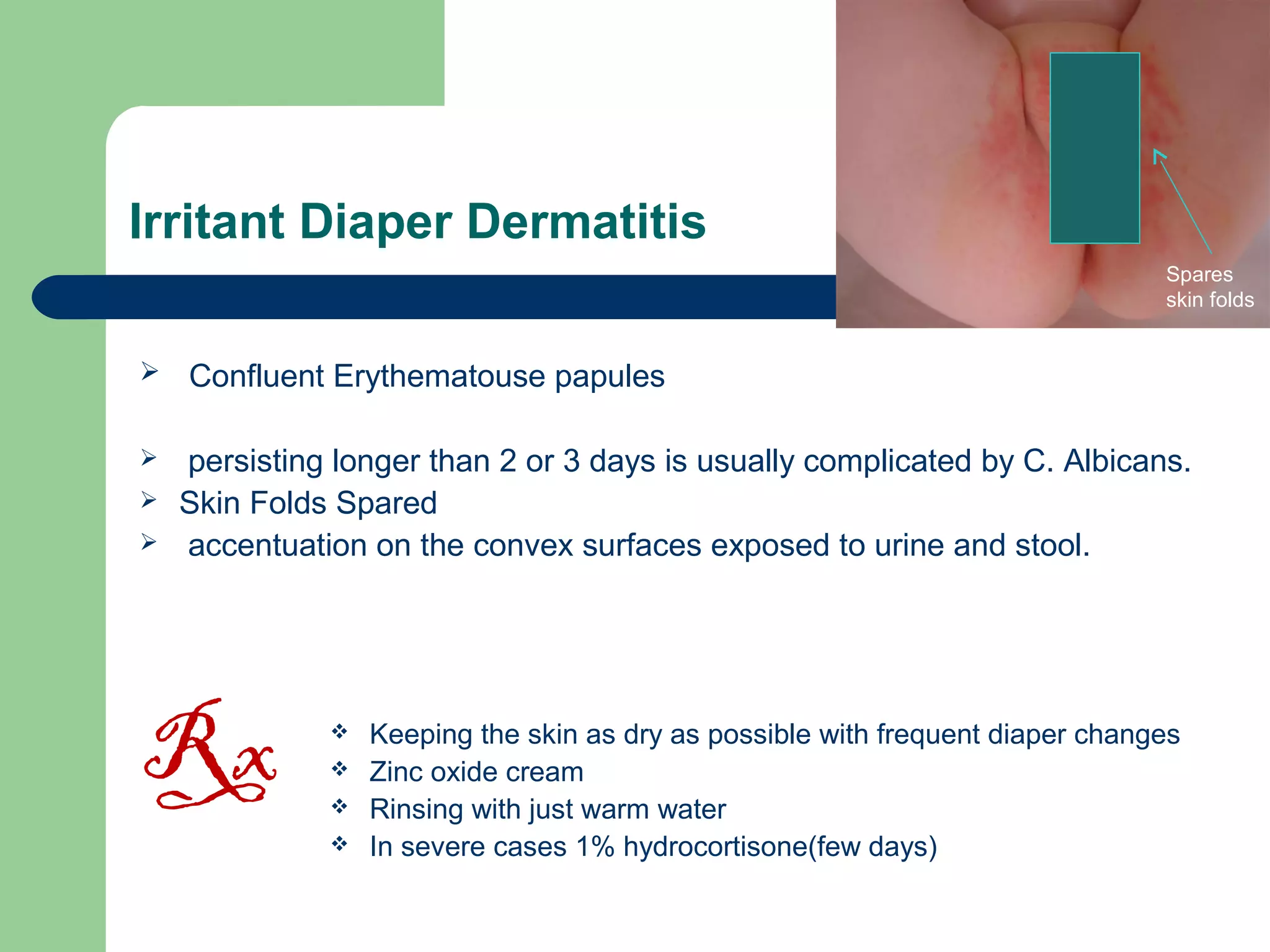 Common neonatal problems | PPT