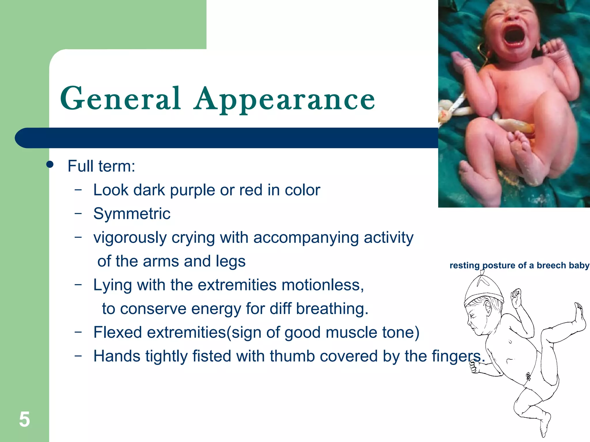 Common neonatal problems | PPT