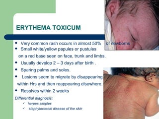 Common neonatal problems | PPT