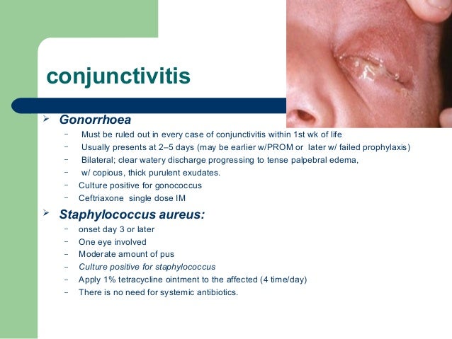 Common neonatal problems