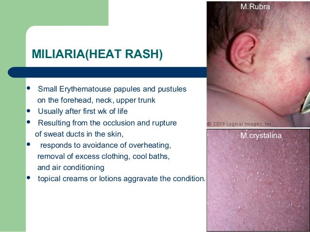 Common neonatal problems