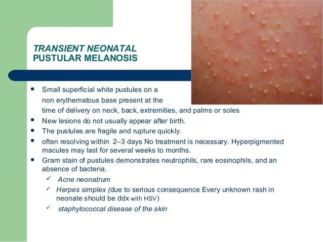 Neonatal Pustular Rash