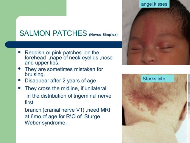 Common neonatal problems