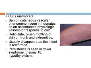 COMMON NEONATAL PROBLEMS.pptx