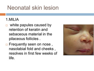 COMMON NEONATAL PROBLEMS.pptx