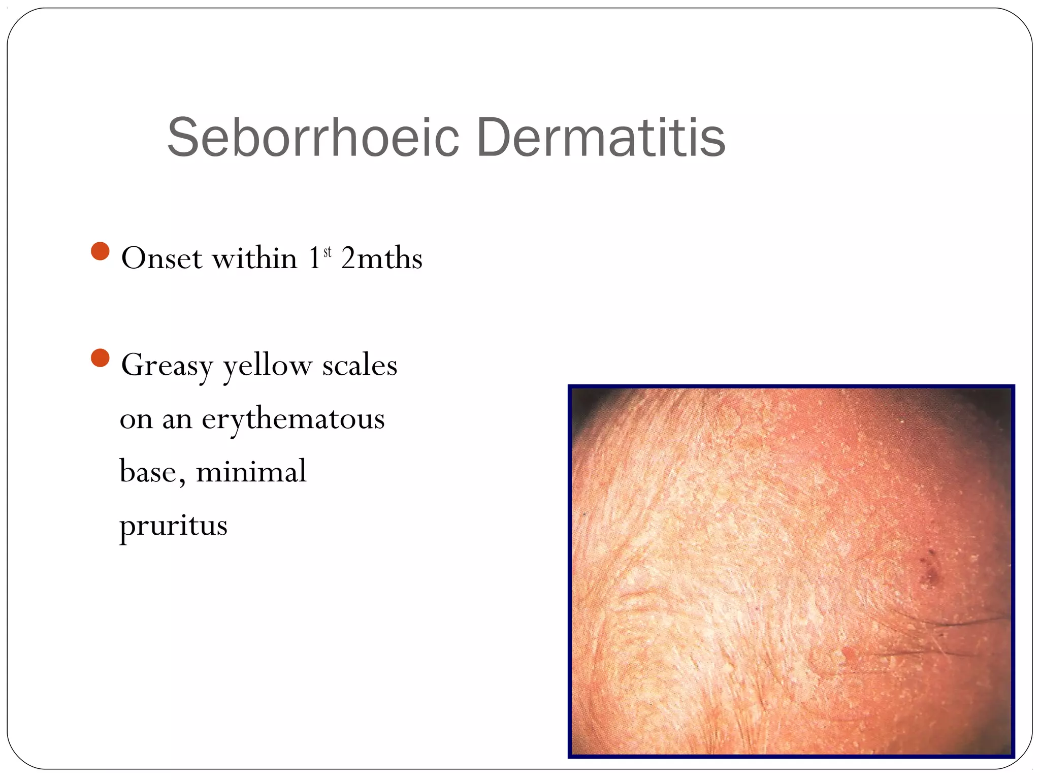 Common neonatal skin problems | PPT