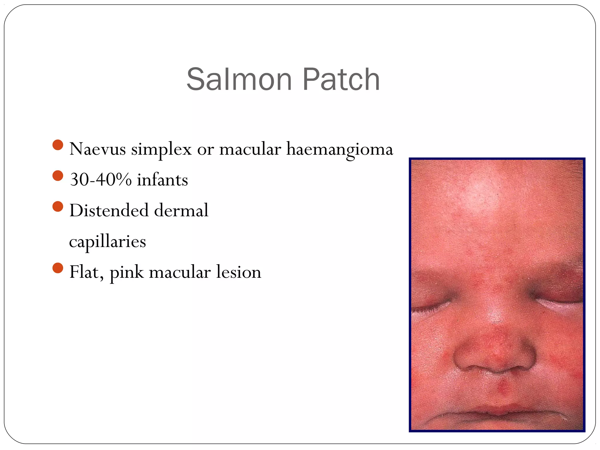 Common neonatal skin problems | PPT