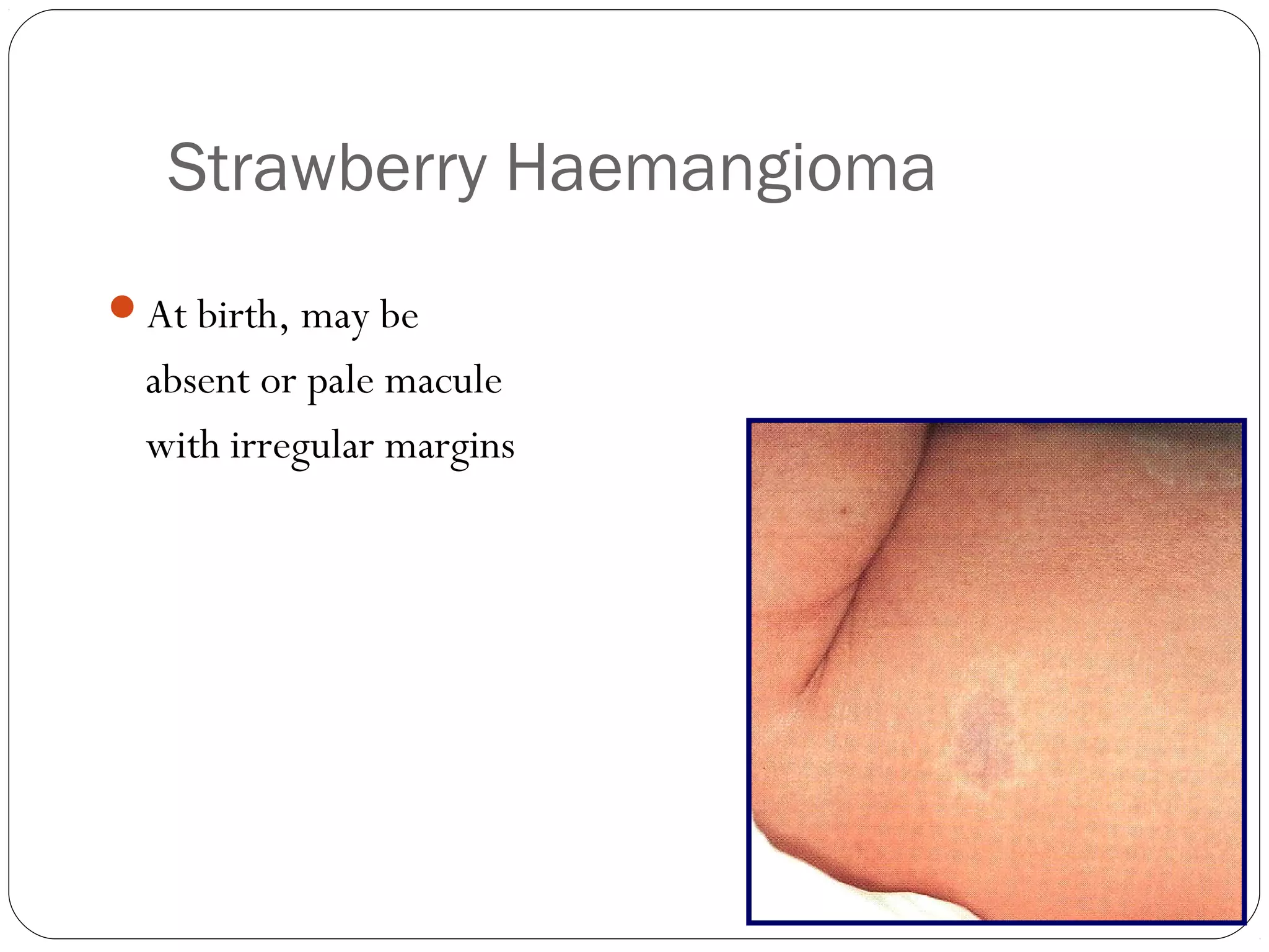 Common neonatal skin problems | PPT