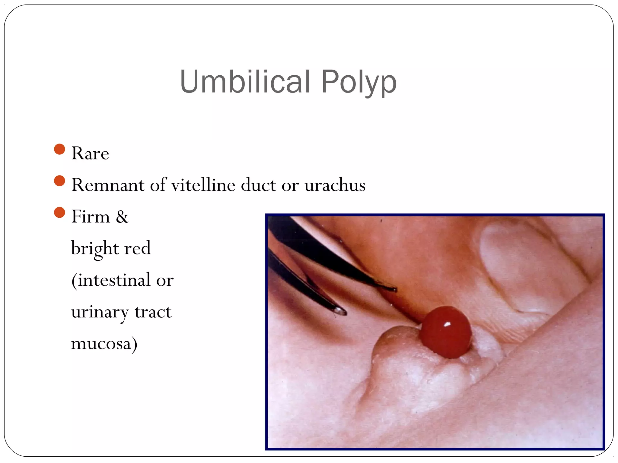 Common neonatal skin problems | PPT